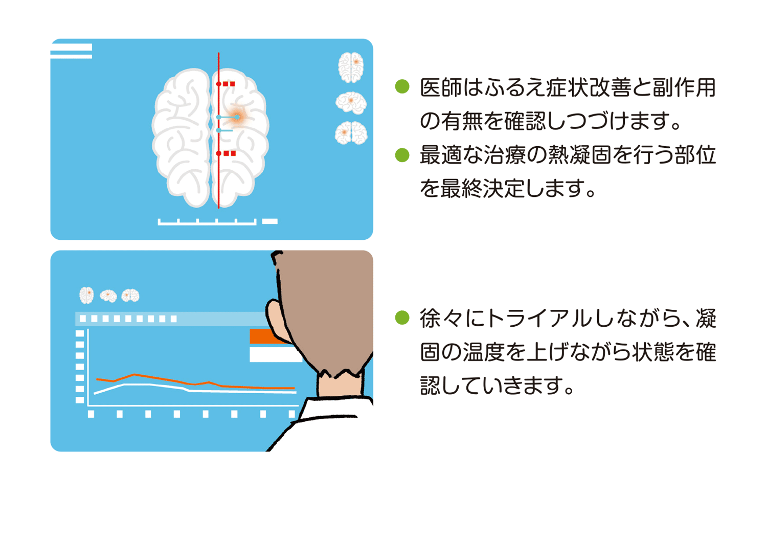 FUS治療のながれ｜お役立ち資料｜INSIGHTEC